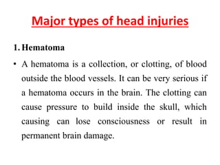 Head injury.pdf