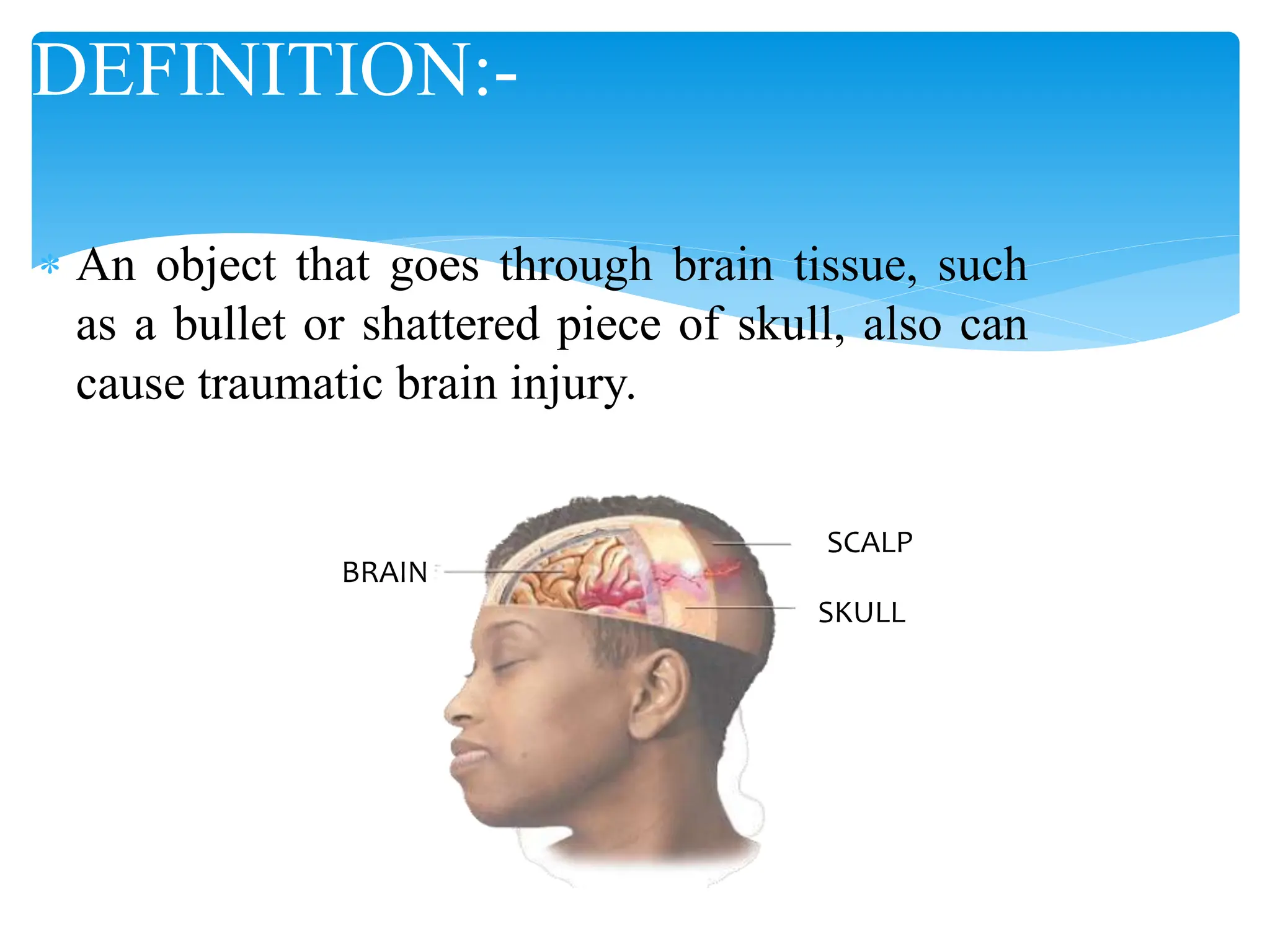 head injury accidental injury RTA .pptx