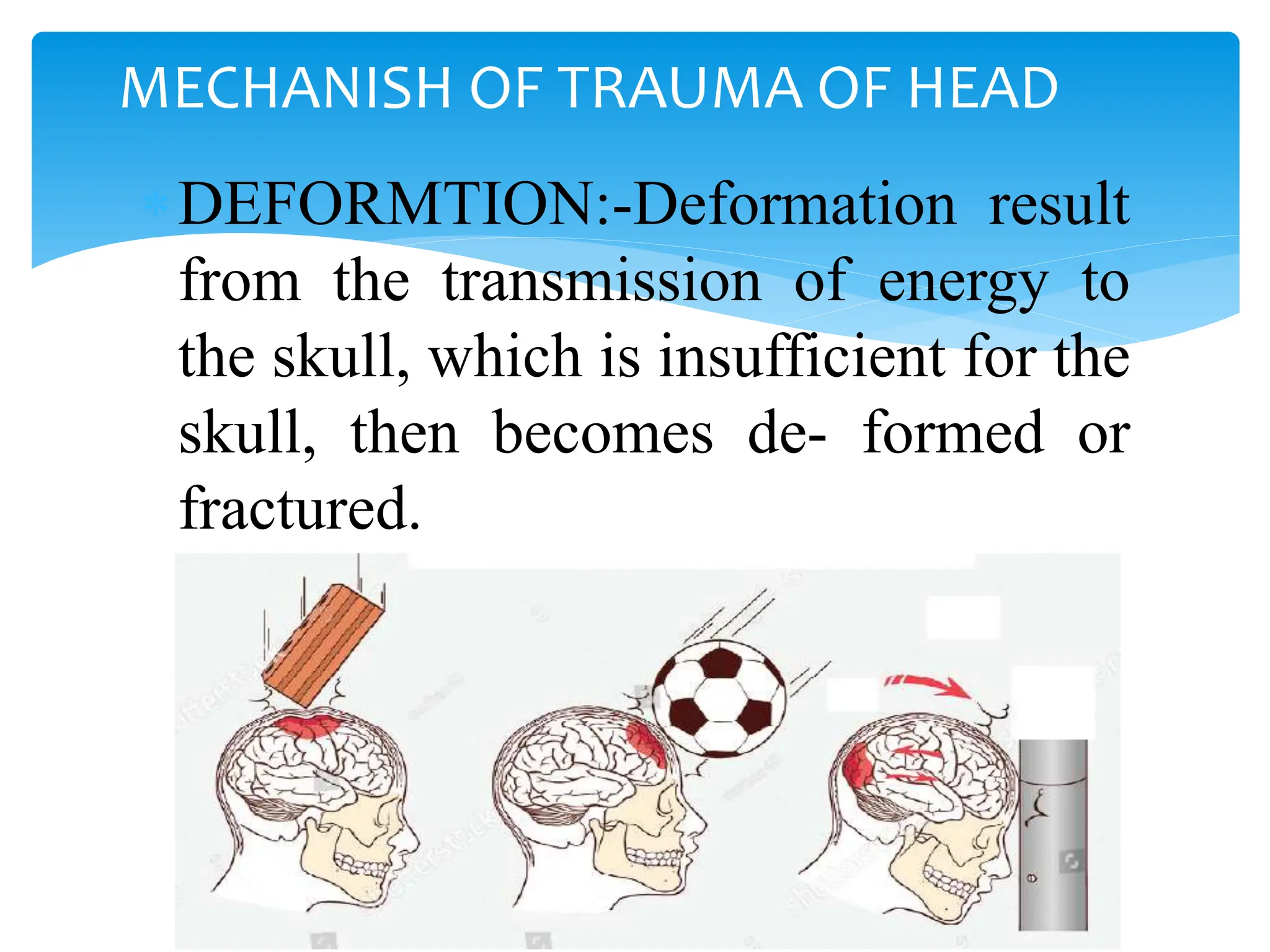 head injury accidental injury RTA .pptx