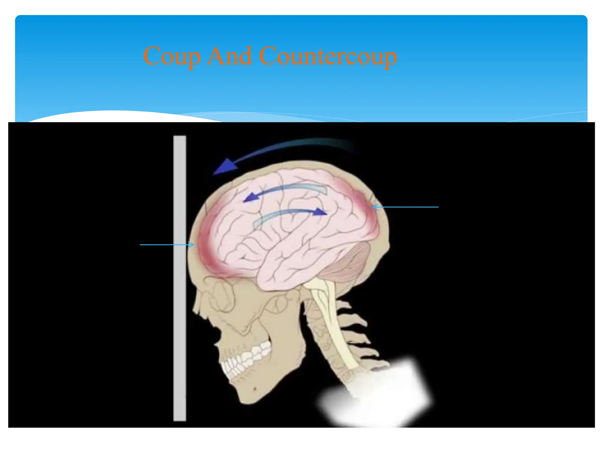 head injury accidental injury RTA .pptx