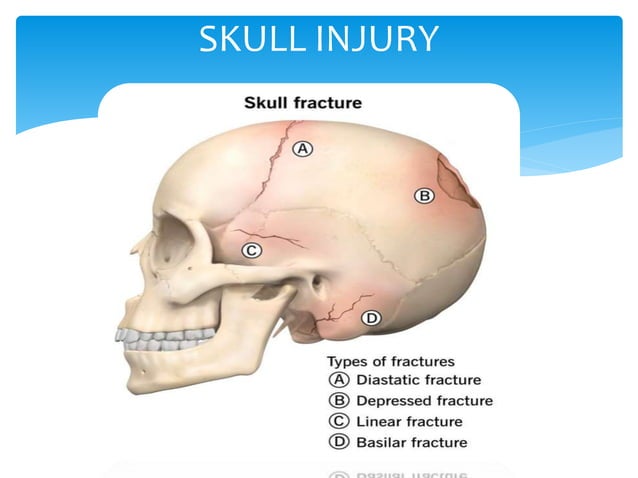 head injury accidental injury RTA .pptx
