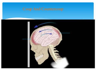 head injury accidental injury RTA .pptx