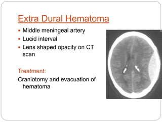 Head Injury. types and managementand primary care | PPTX