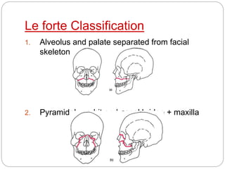 Head Injury. types and managementand primary care | PPTX