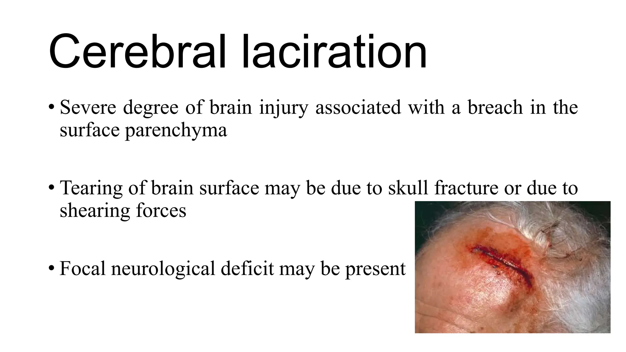 Head injury.pptx (medicl surgical nursing) | PPTX