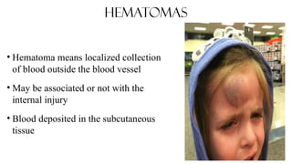 Head Injury in children and its prevention.pptx
