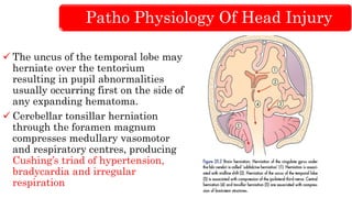 HEAD INJURY- AN OVERVIEW | PPTX