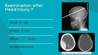 Head Injury - HT.pptx