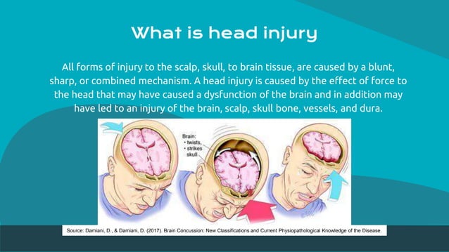 Head Injury - HT.pptx