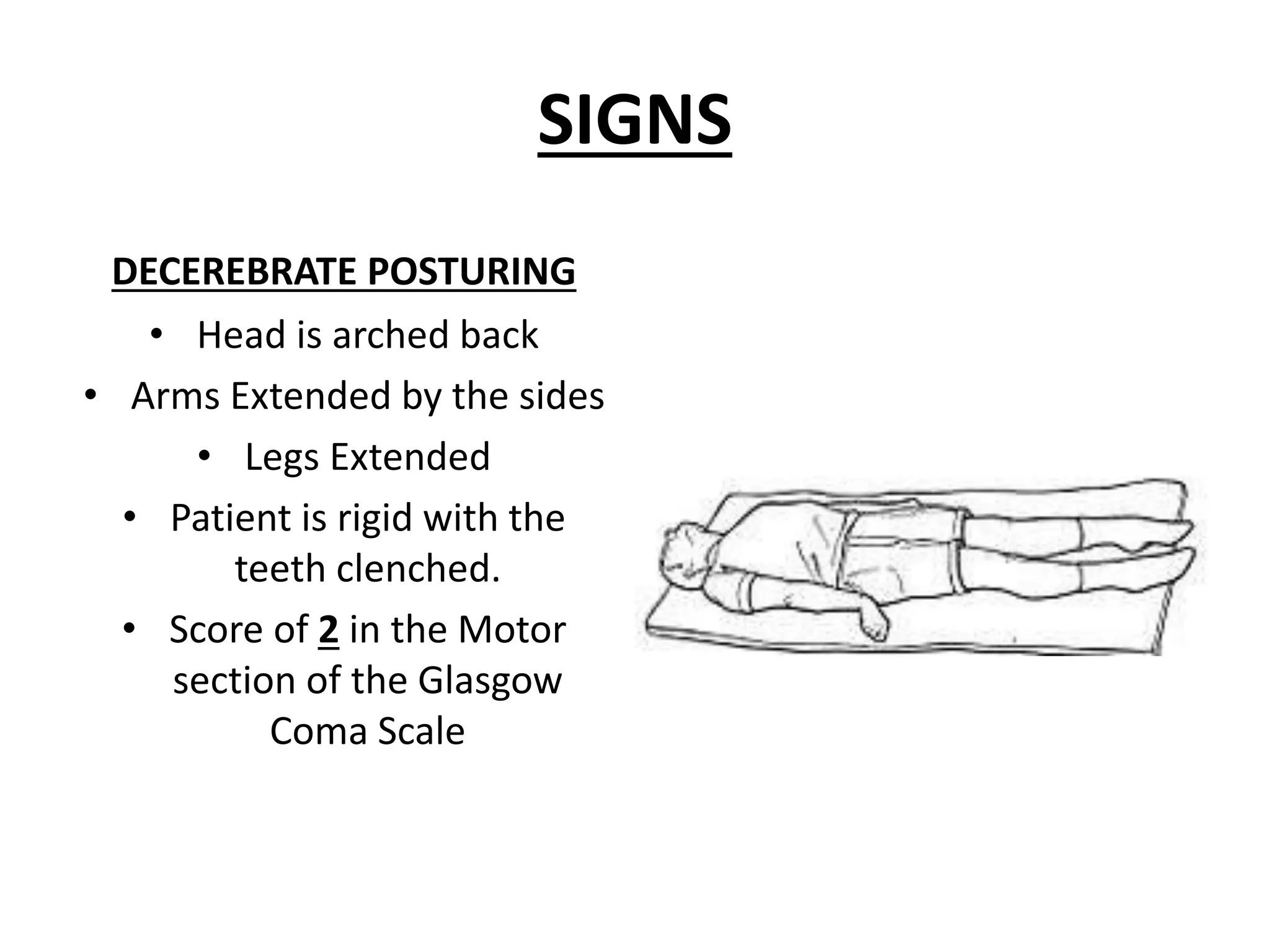 Head injuries Overview | PPTX