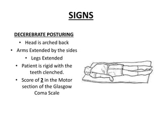 Head injuries Overview | PPT