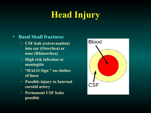 Head injury types, clinical manifestations, diagnosis and management ...