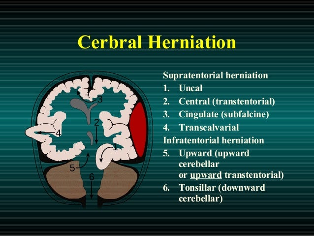 Head injury types, clinical manifestations, diagnosis and management