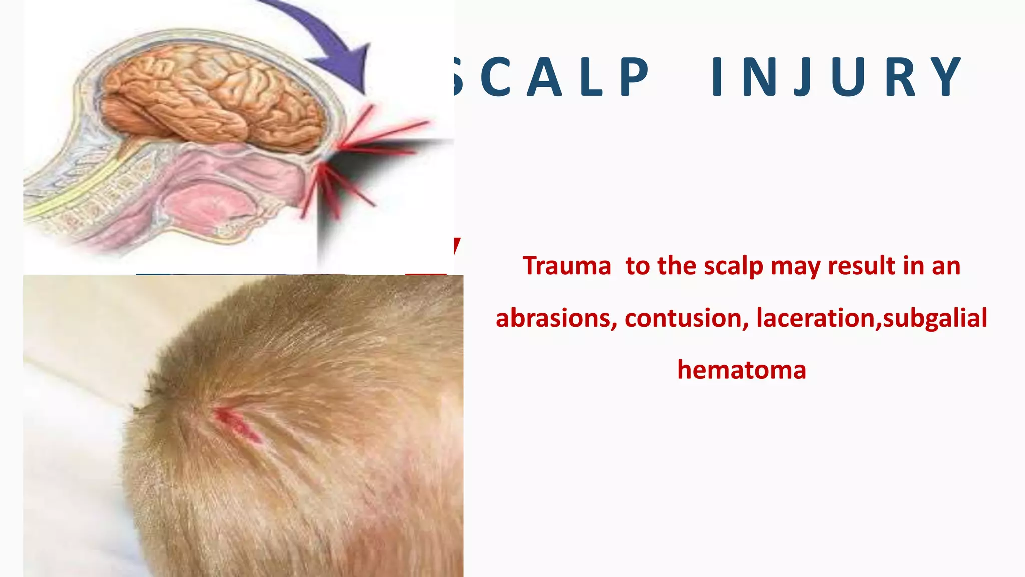 Head injury | PPTX