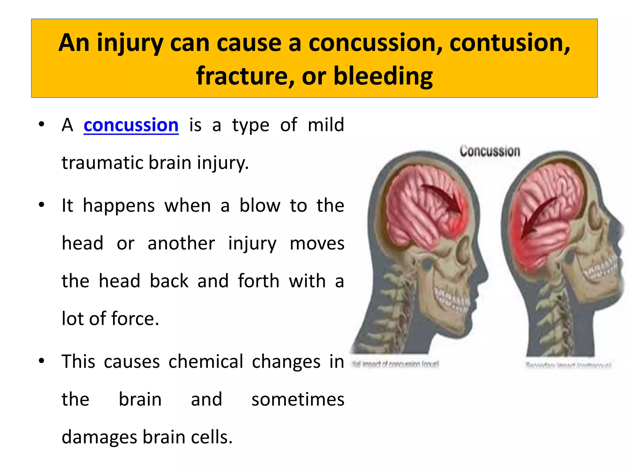Head injury and its management | PPTX