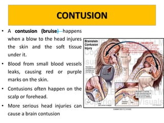 Head injury and its management | PPTX