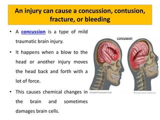 Head injury and its management | PPTX