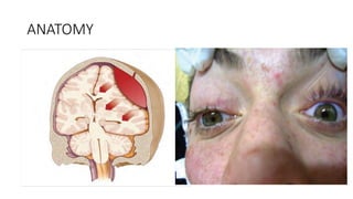 head injury according to ATLS BY DR MUMTAZ ALI.pptx