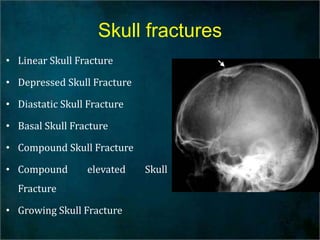 Head injury and medical tratment | PPTX