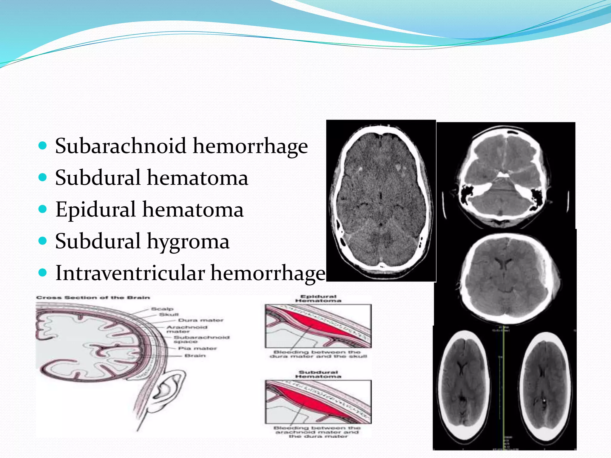 Head injury classification & grading | PPT