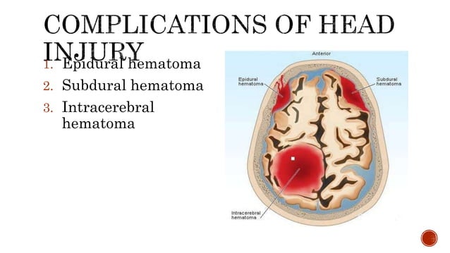 Head Injury (Traumatic Brain Injury) - types, complications and ...