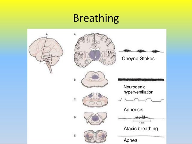 Ataxic Breathing 14 Warning Signs And Symptoms Of Brain Tumor