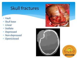 Head Injury: Common Issues | PPTX