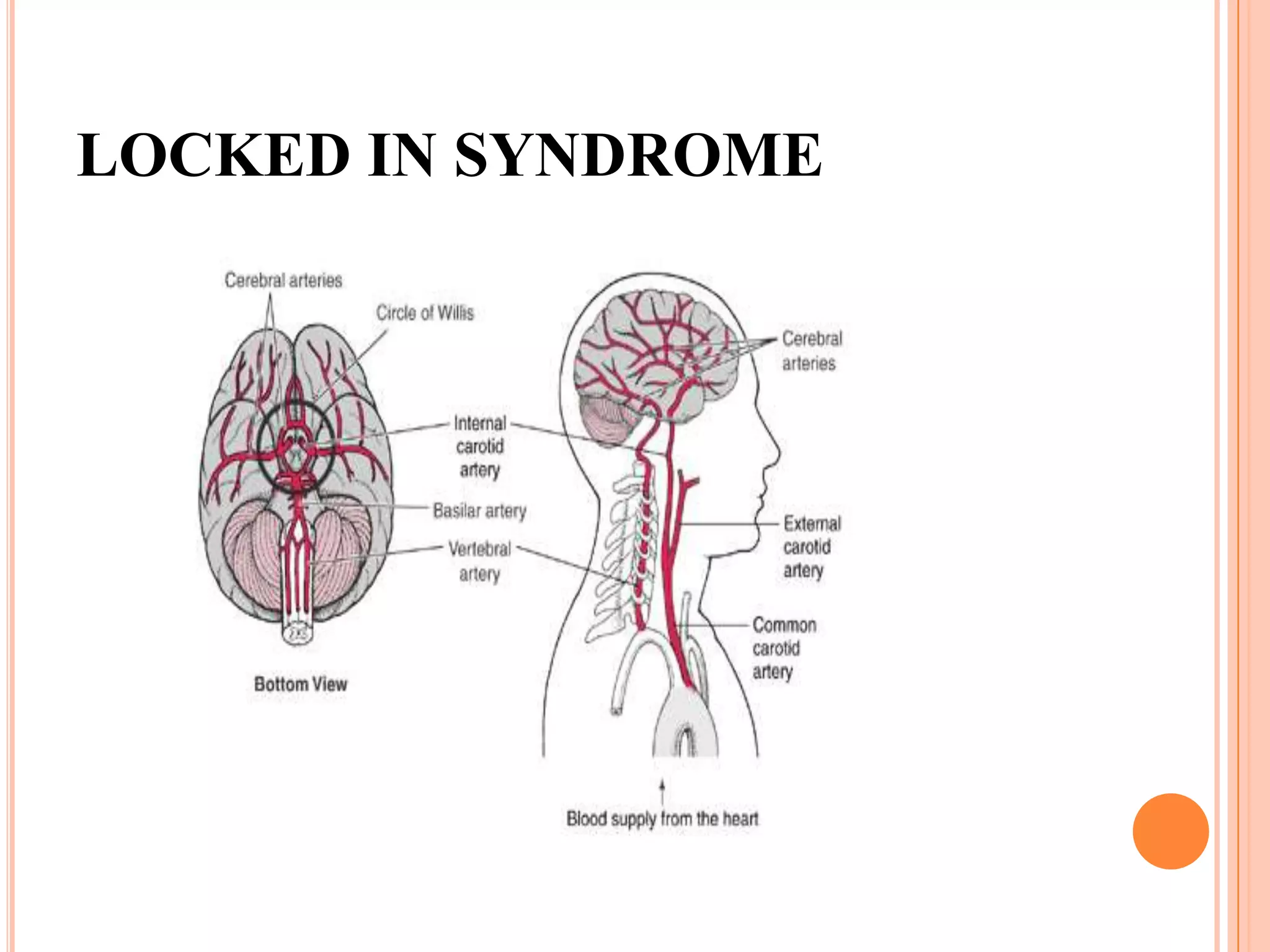 Head injury ppt | PPTX | Death, Injury, or Military Conflict ...