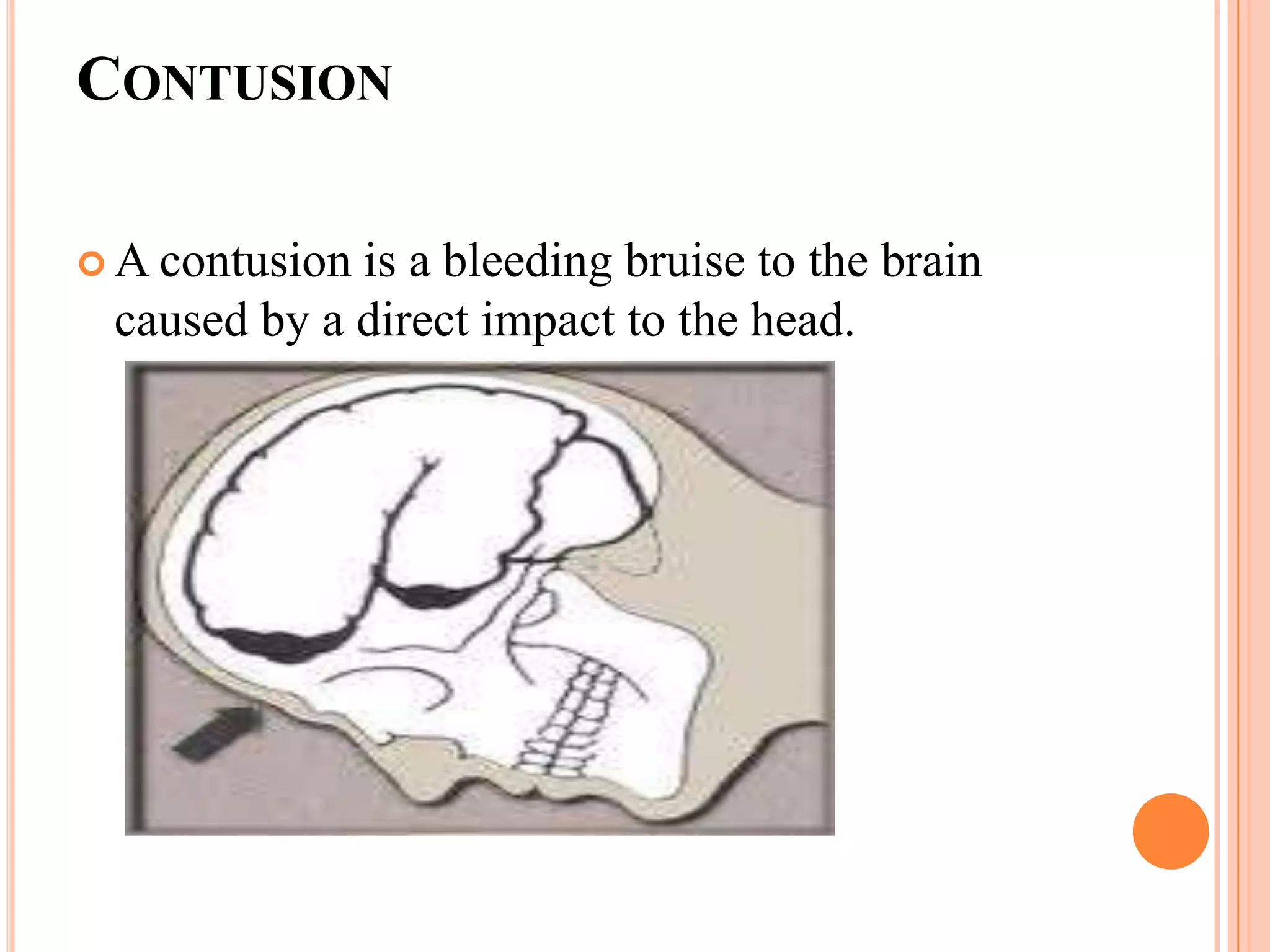 Head injury ppt | PPTX