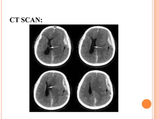 Head injury ppt | PPTX