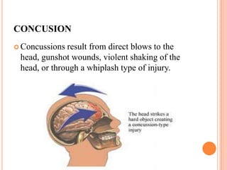 Head injury ppt | PPTX
