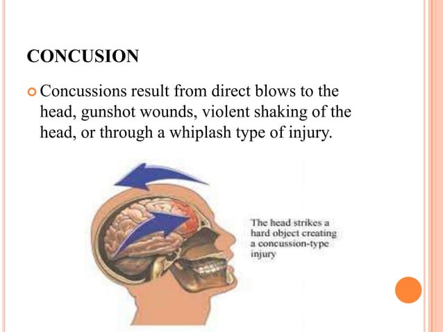 Head injury ppt | PPTX | Death, Injury, or Military Conflict ...