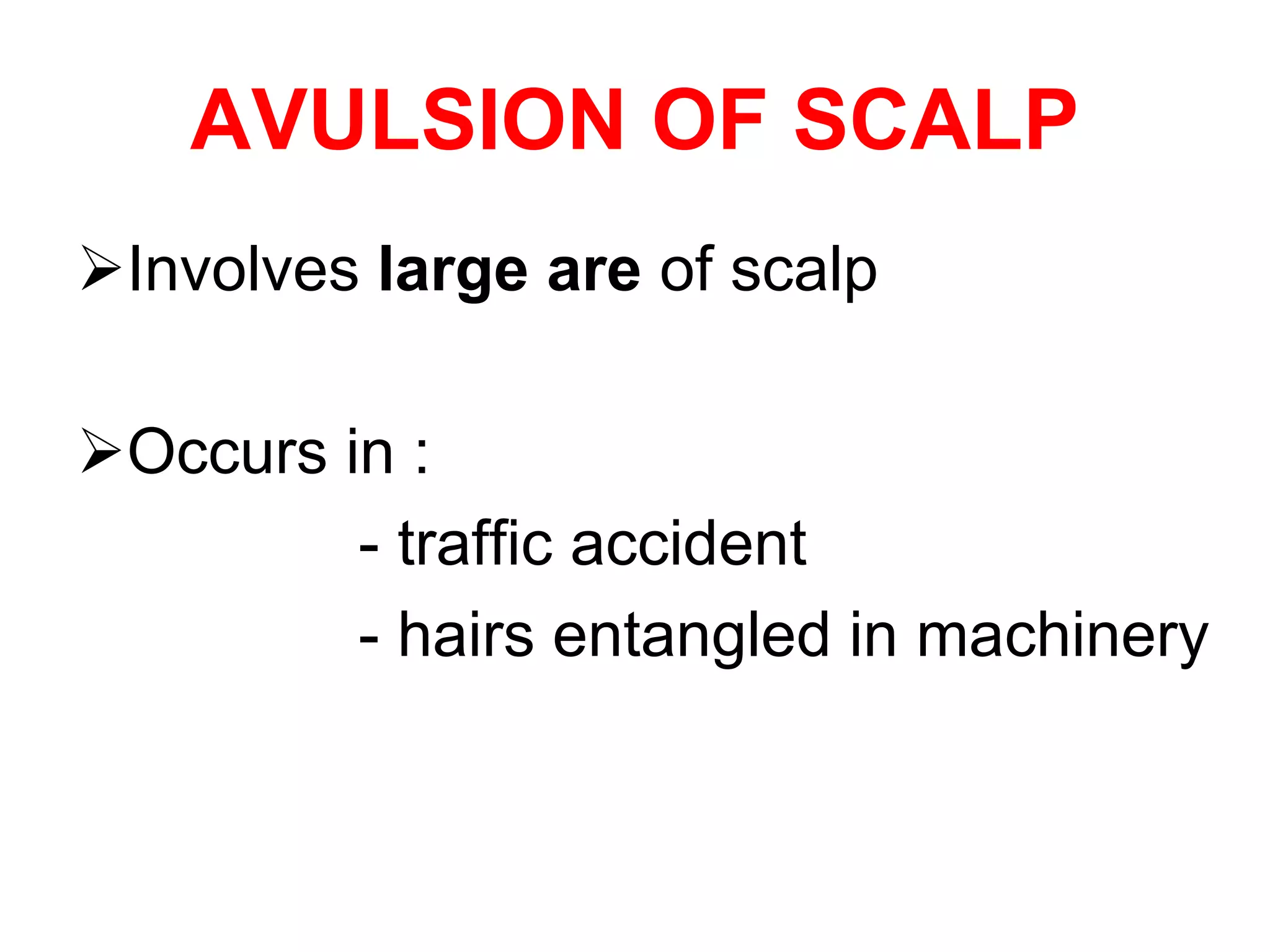 HEAD_INJURY_PPT.ppt