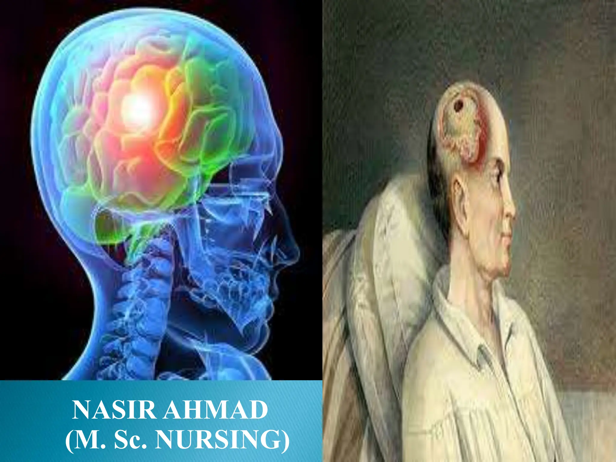 HEAD INJURY PREPARED AND DESIGNED BY NASIR AHMAD | PPT