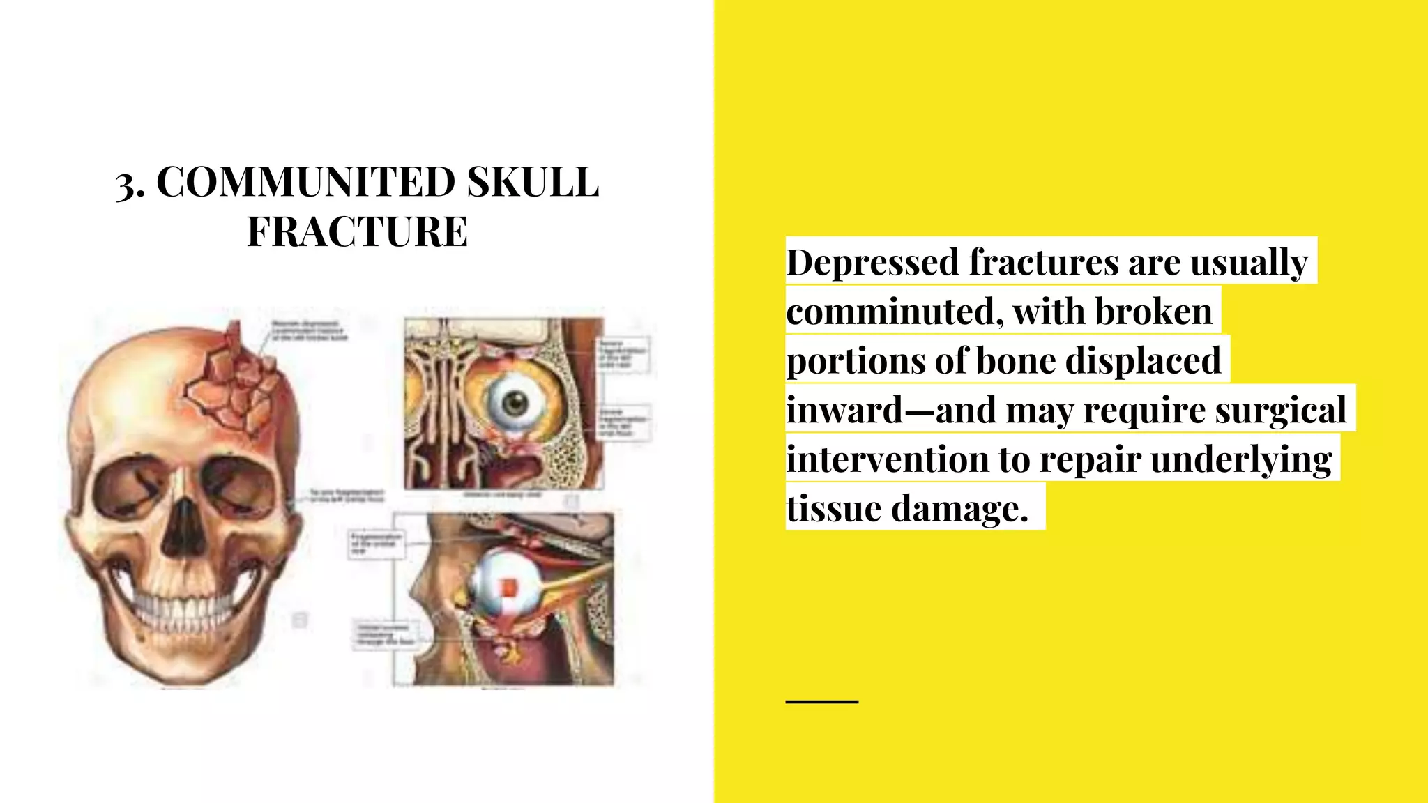 Head injury presentation | PPTX