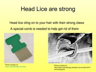Head Lice | PPT