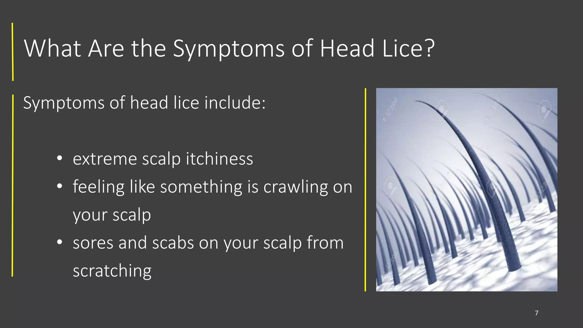 Head Lice (Louse) | PPTX