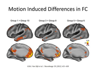 Head Motion in fMRI | PPTX