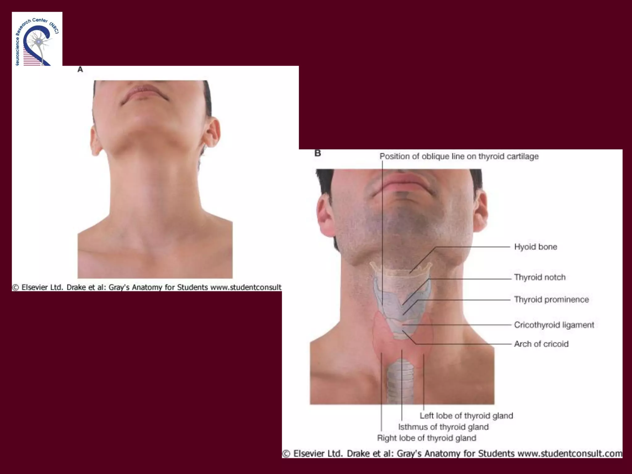 Head & neck anatomy session iii & iv neck | PPT