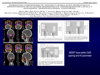 Head & neck cancer | PPT