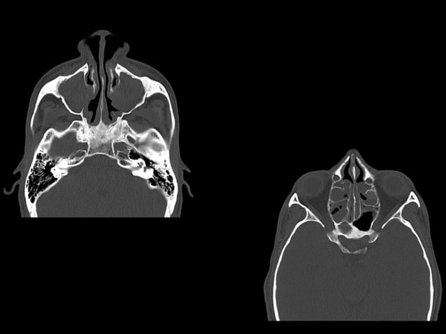 head & Neck Radiology .ppt MBBS lecture 1 | PPT