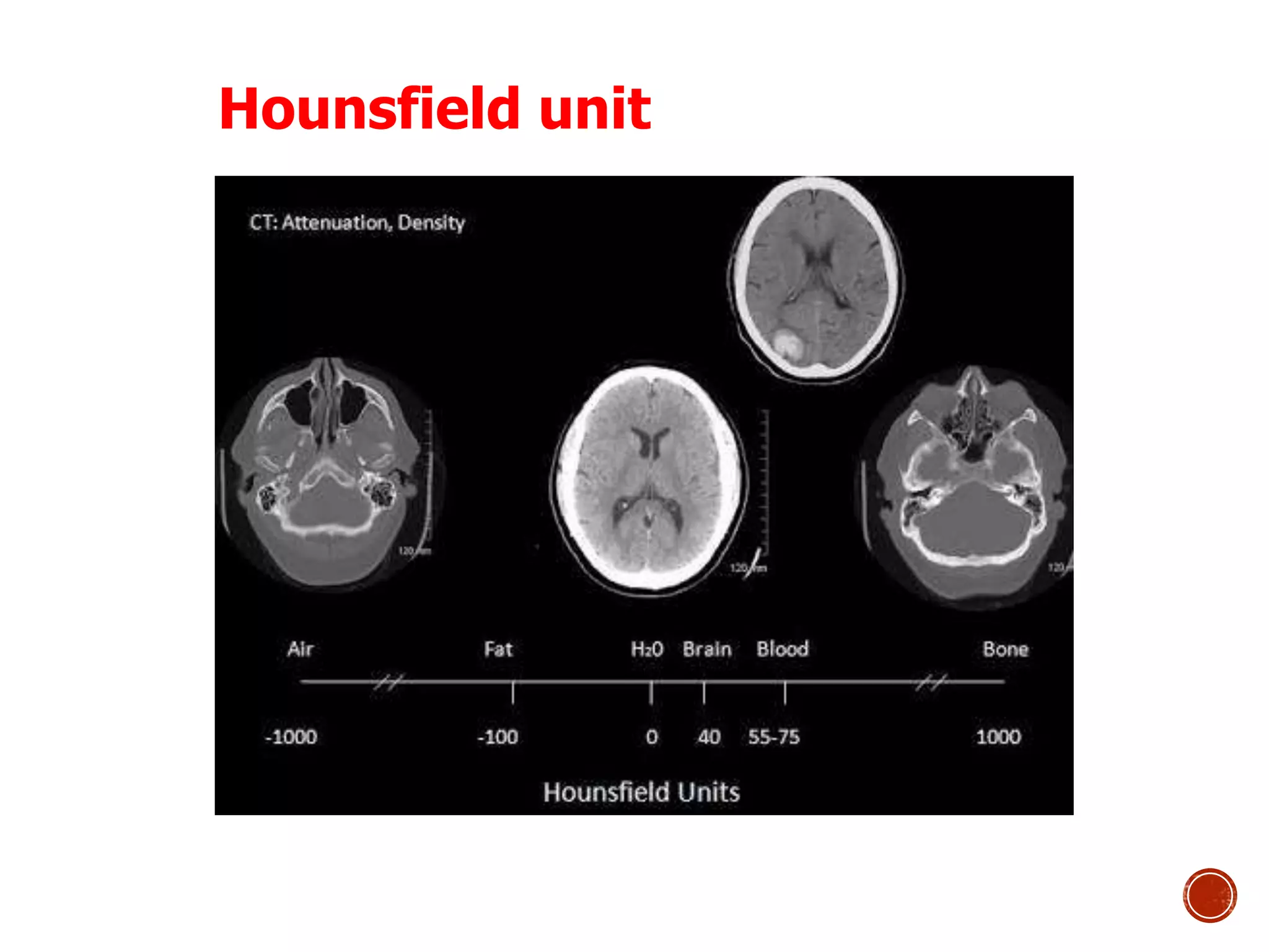 Head & Neck Radiology ppt | PPT