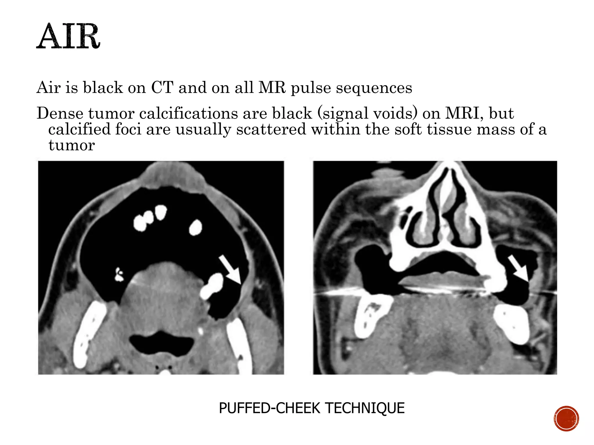 Head & Neck Radiology ppt | PPT