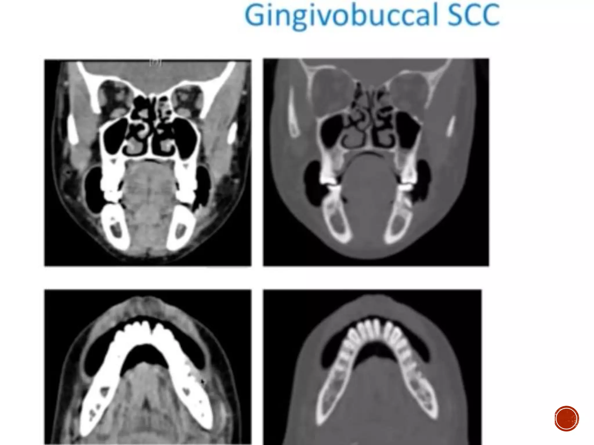 Head & Neck Radiology ppt | PPT