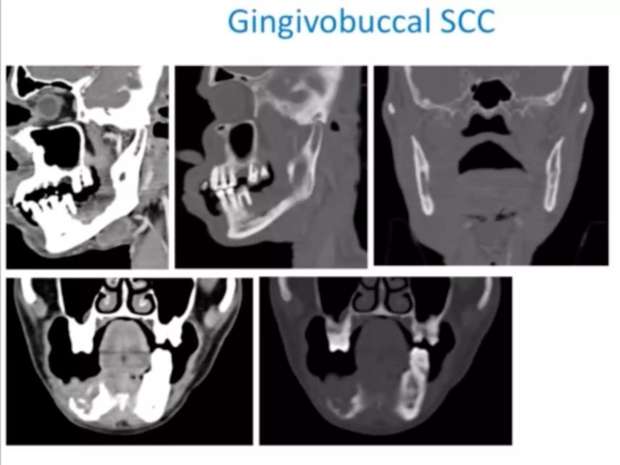 Head & Neck Radiology ppt | PPT