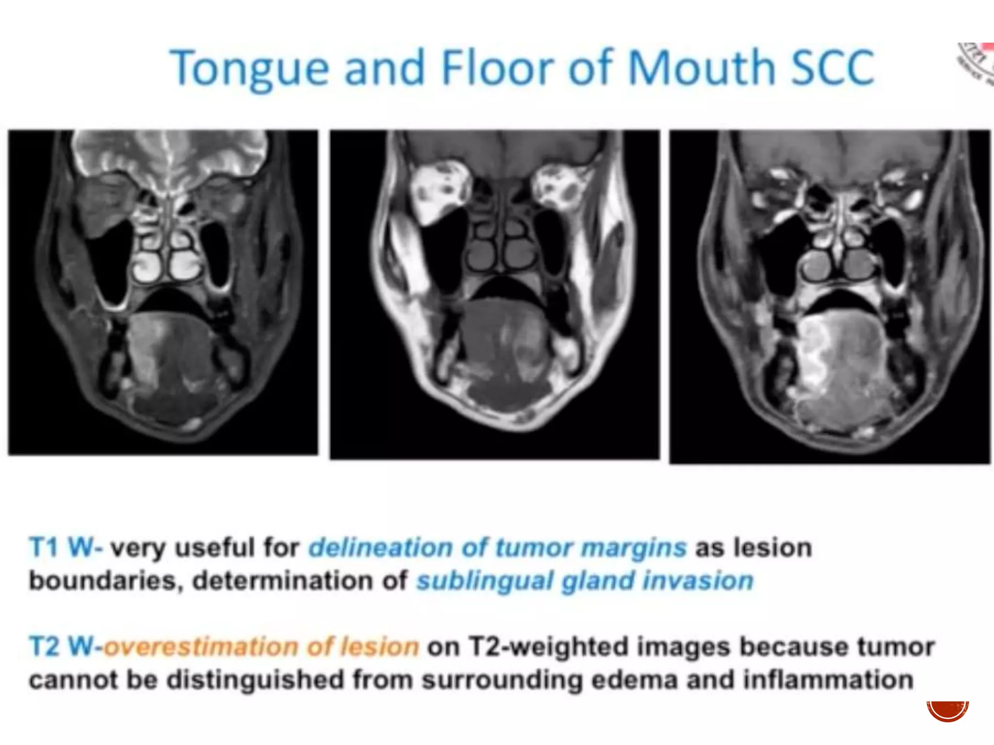Head & Neck Radiology ppt | PPT