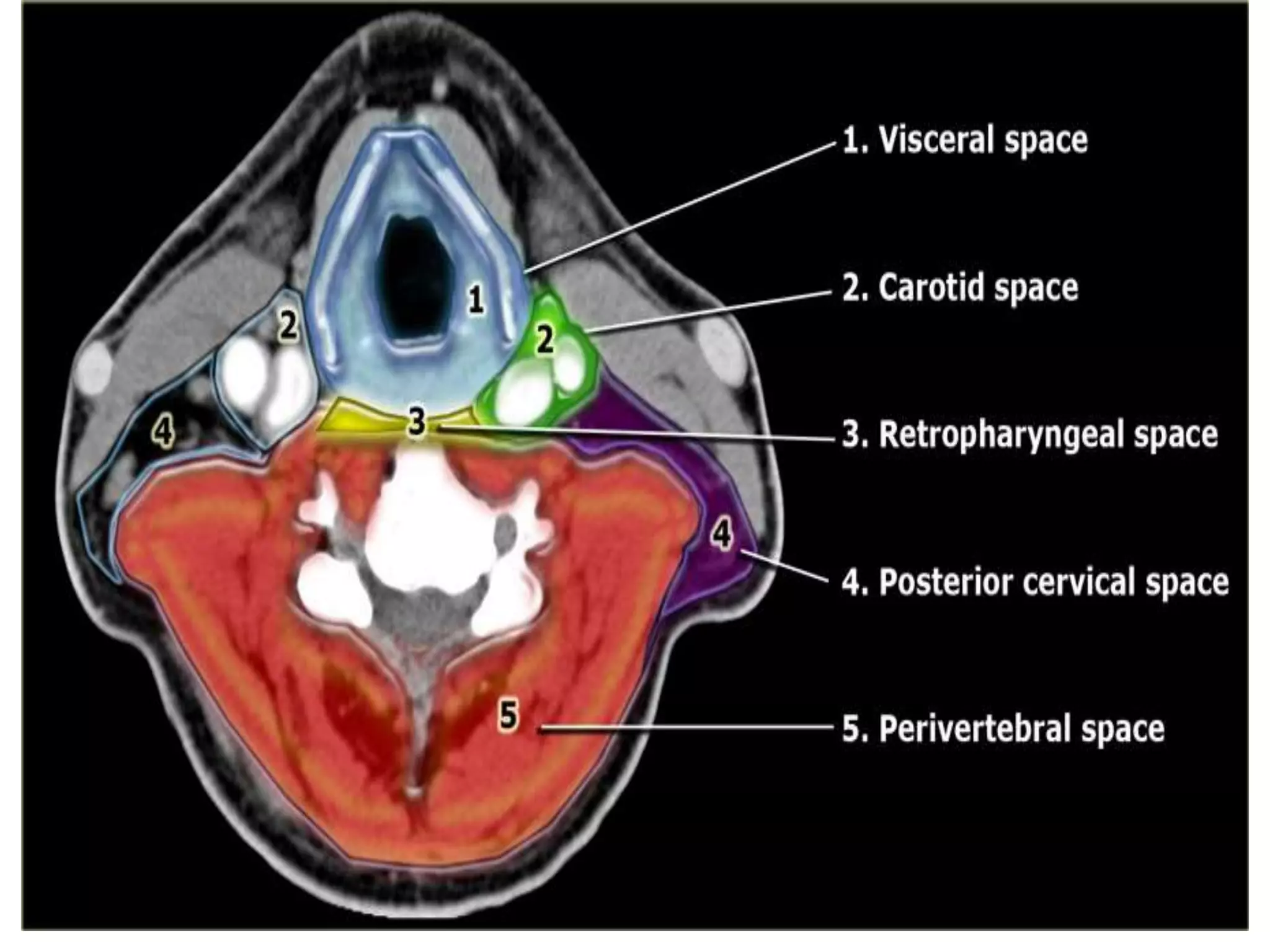 Head & Neck Radiology ppt | PPT