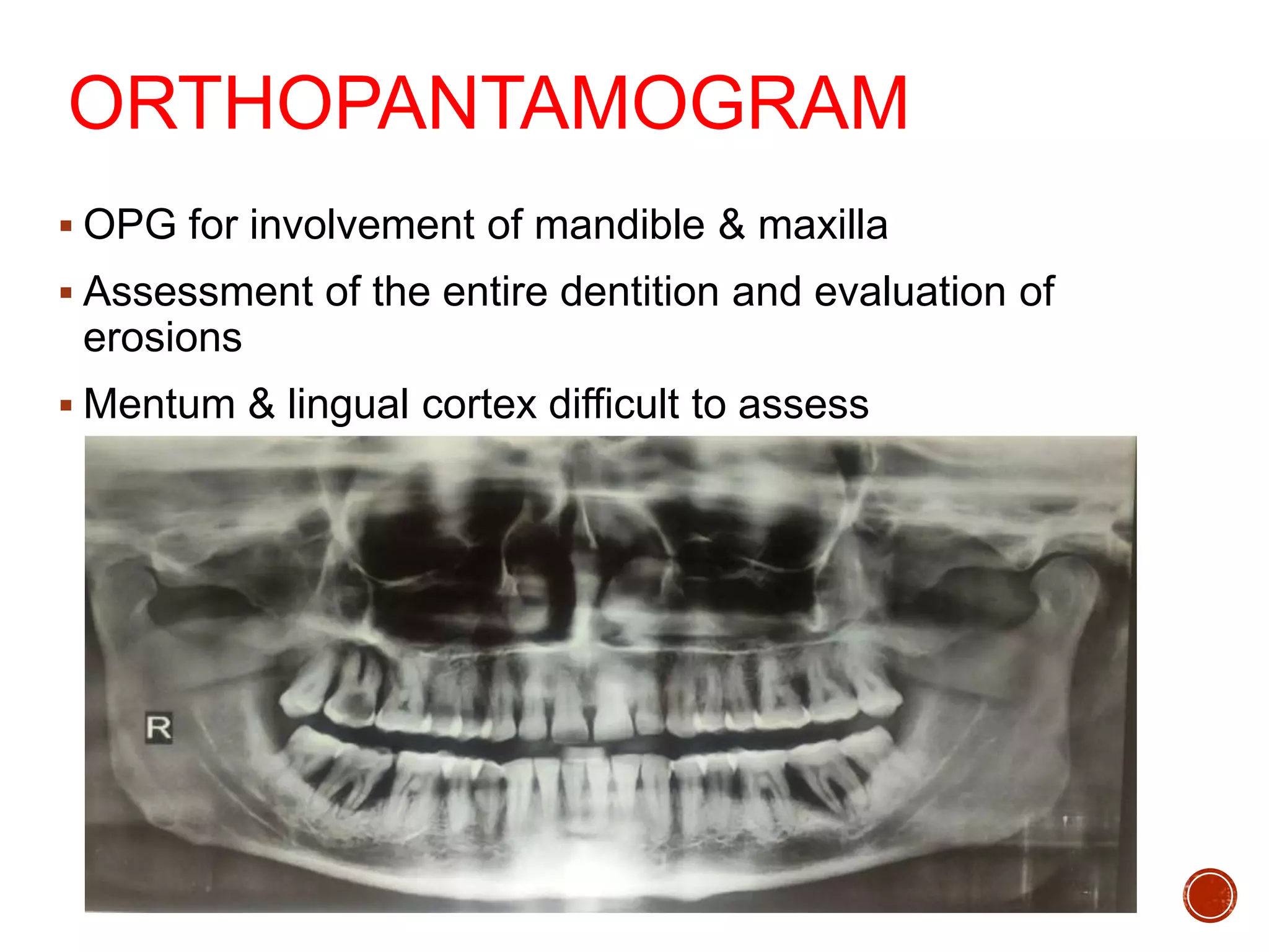 Head & Neck Radiology ppt | PPT