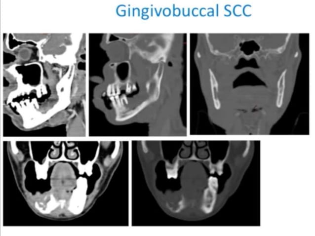 Head & Neck Radiology ppt | PPT | Bone and Joint Conditions | Diseases ...