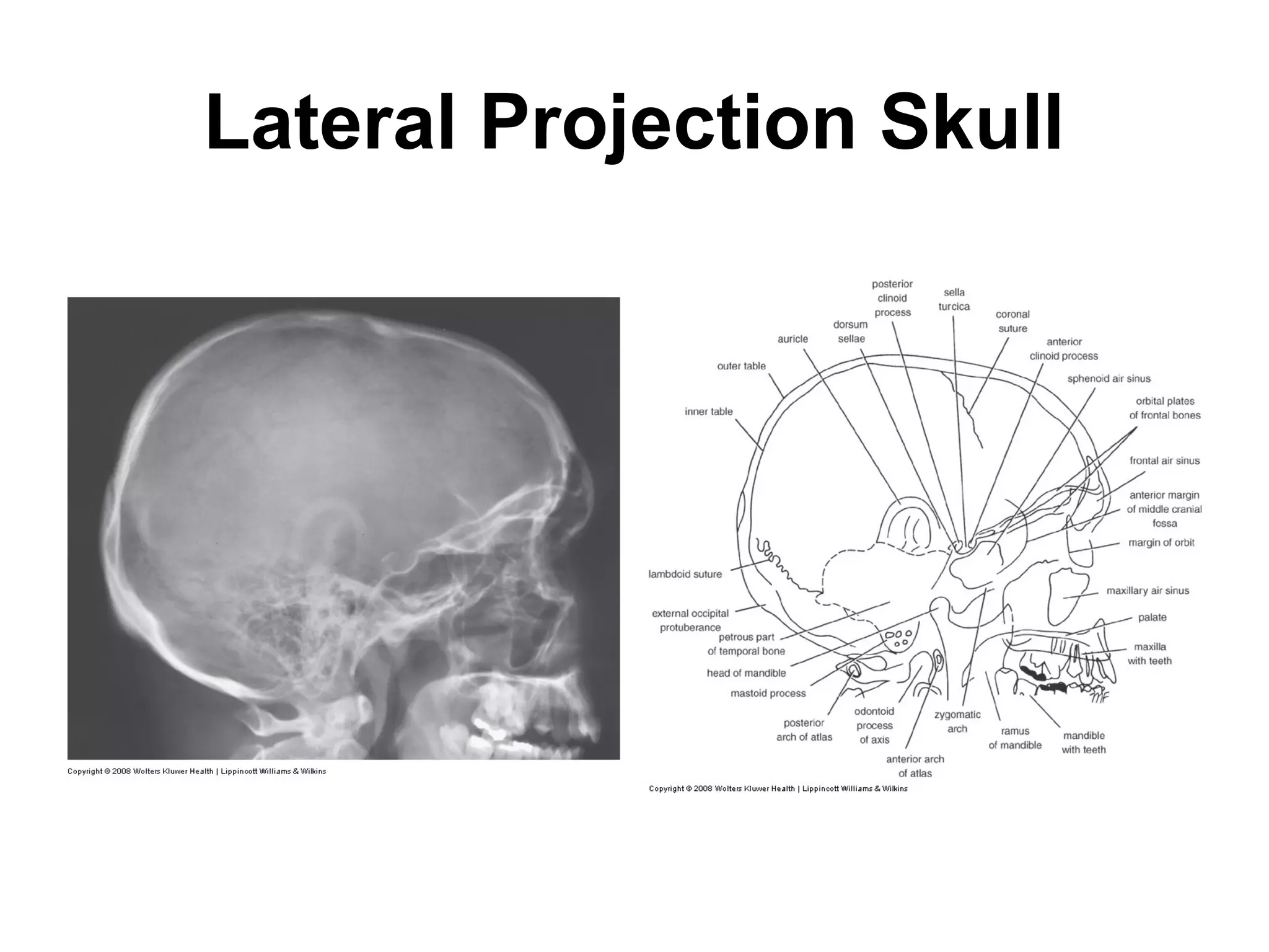Head & neck rs x-rays | PPT